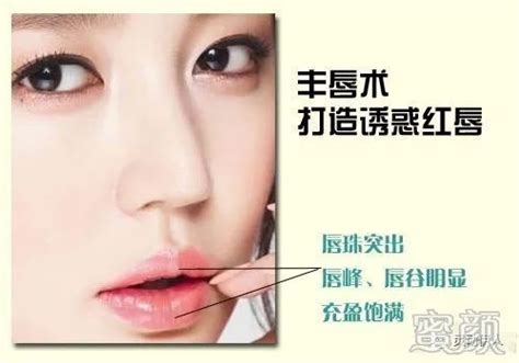 唇珠成形术好吗 手术安全吗 恢复需要多长时间 蜜颜优惠