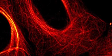 Molecular Imaging Of Dynamic Cellular Processes Frei Research Group Chemical Biology And
