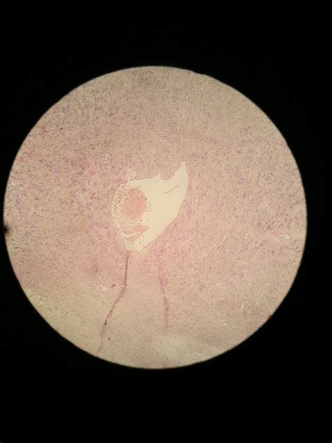 What Is The Differential Diagnosis Of This Right Auricular Swelling Researchgate