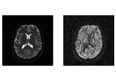 Examples Dipy 1 11 0 Documentation