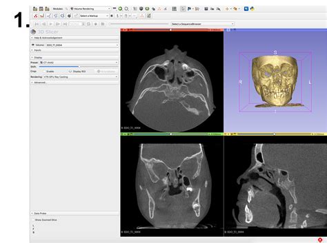 Harden Transform Is Applied For Volume Rendering But Not For Scan