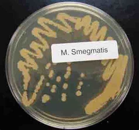 Mycobacterium Smegmatis ~ Everything You Need To Know With Photos Videos