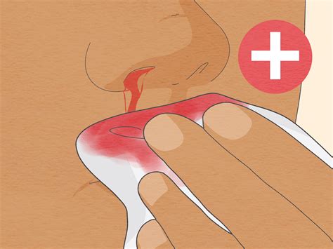 Internal Bleeding Symptoms Causes And Treatment Internal Bleeding