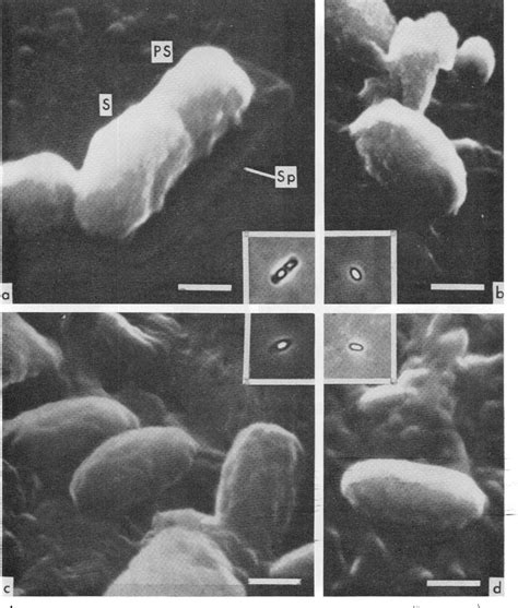 Scanning Electron Microscope Bacteria
