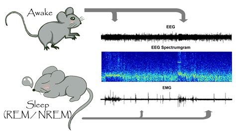 Github Li Shen Amyeegsleep Matlab Code For Sleep Cycle Analysis From Eeg Signals