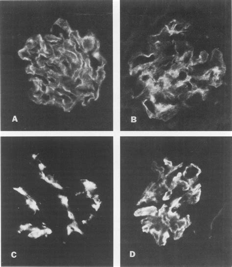 A Immunofluorescence Photomicrograph Of Glomerulus From A Mouse Given Download Scientific