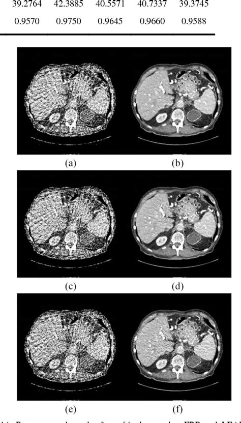 Learn Learned Experts Assessment Based Reconstruction Network For Sparse Data Ct