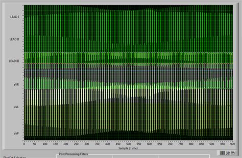 Ads1298 Ads1298 Dc Lead Off Detection Data Converters Forum Data
