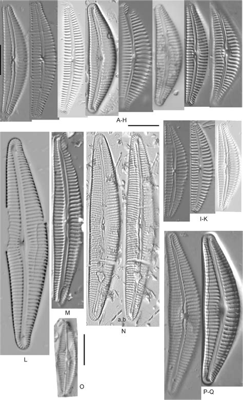 Diatom Light Microscope Images A K Cymbella Parva Wsmith Kirchner