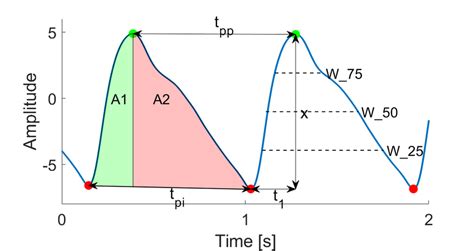 Ppg Signal With Some Time Domain Features Download Scientific Diagram