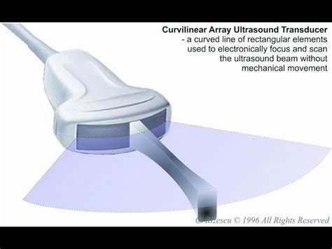 Curvilinear Probe Ultrasound