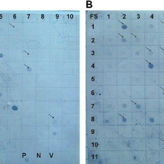Complementary DNA Microarray For The Susceptible Strain S Lab And The Download Scientific