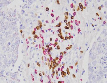 Kappa Lambda Probe Kit ISH