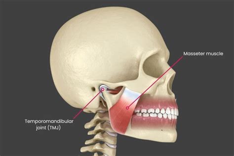 Zoe Balls Temporomandibular Joint Disorder Tmj Tmd