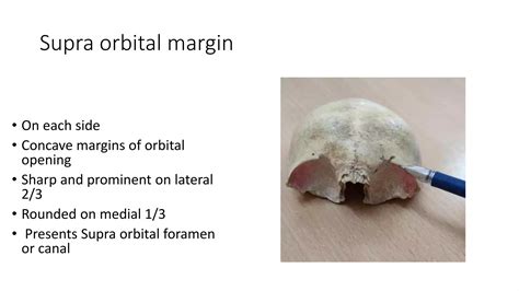 Frontal Bone Ppt 1 Pptx