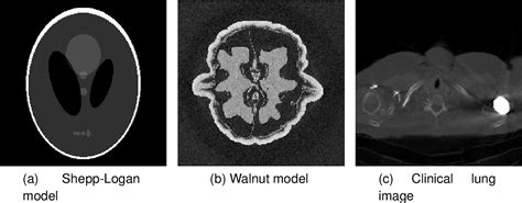 Figure 2 From Sparse View X Ray Ct Based On A Box Constrained Nonlinear Weighted Anisotropic Tv
