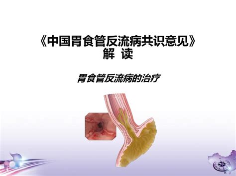 中国胃食管反流病共识意见word文档在线阅读与下载无忧文档