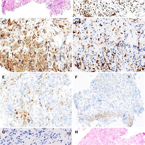 Summary Of 10 Reported Cases Of Methotrexate Associated Download Scientific Diagram