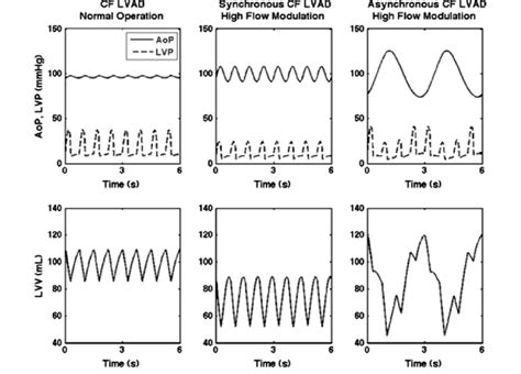 Aop Lvp Lvv For Normal Cf Lvad Synchronous Cf Lvad With High Flow Download Scientific