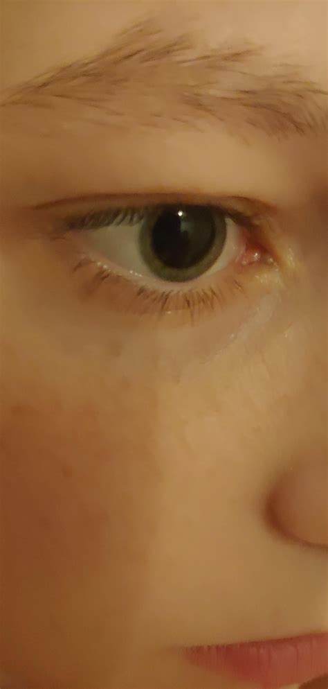 Do U Guys Often Get Told U Have Big Pupils Im Not On Drugs I Swear