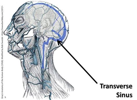 Transverse Sinus The Anatomy Of The Veins Visual Guide Flickr