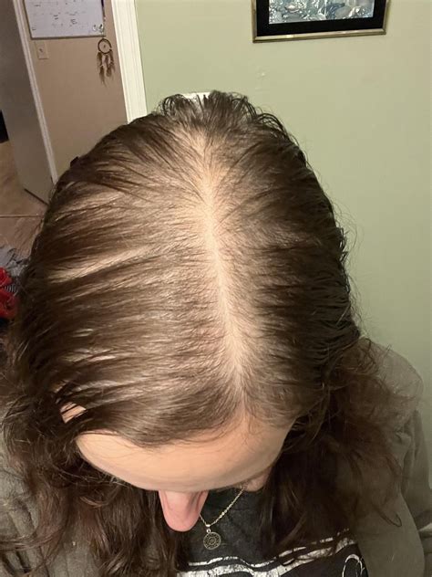 I Need Help Im Desperate Im Ashamed Of My Hair Always Have Been I