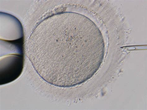 Assisted Reproductive Technology Art Pesquisa Clínica Solutions