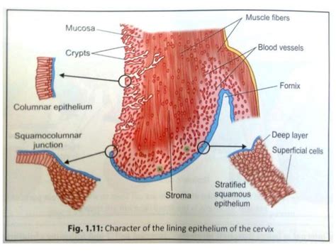 Cervical Biopsy Obstetrics And Gynaecology