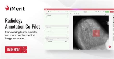 Imerit Technology On Linkedin Rsna2024 Radiology Healthcareai
