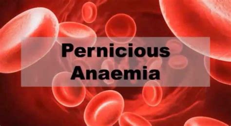Pernicious Anemia Causes Signs Symptoms Treatment