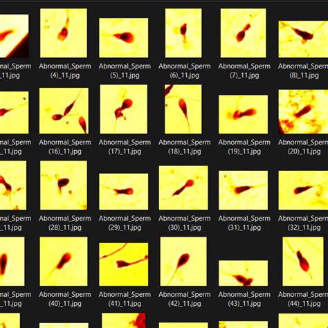 Sperm Colorized Morphology Images Kaggle