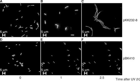 Fluorescence Microscopy Of Uv Exposed 50 J M2 Cells Carrying The