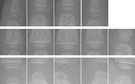The 14 Extracted Ossification Centres Download Scientific Diagram