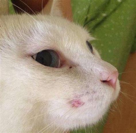 猫藓传染给人的图片 猫藓长在人身上图片 猫藓在人身上症状图片 大山谷图库