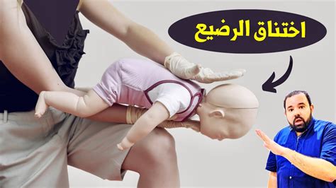 اسعاف الطفل الرضيع عند الاختناق و الشرقة اسعاف الطفل المختنق