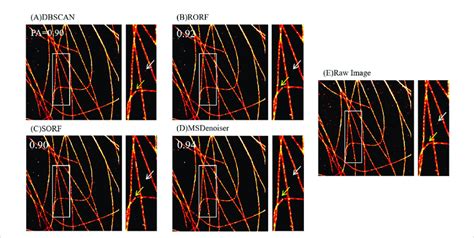 comparison on the denoising performance of different methods using