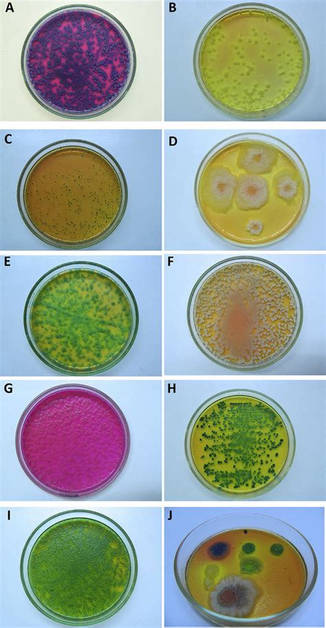 Bacillus Megaterium Agar Bacil Sp Op Tsa Agar Agarplaat