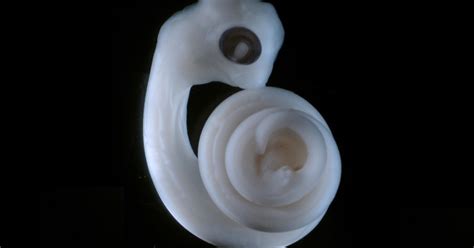 How Sex Organs Got Started It Was An Evolutionary Quickie