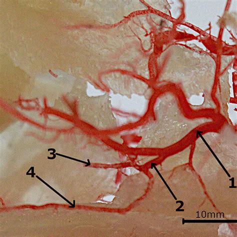 Some Terminal Branches Of The Maxillary Artery Corrosion Cast 1 The