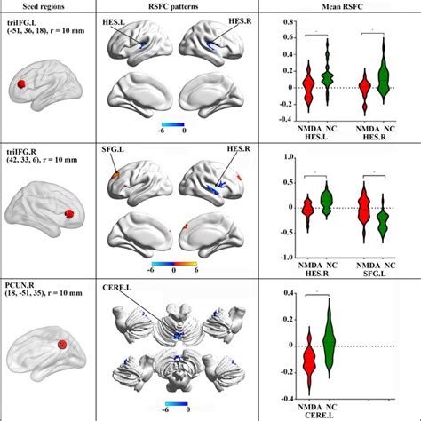 Comparison Of Resting State Functional Connectivity Rsfc In Patients Download Scientific