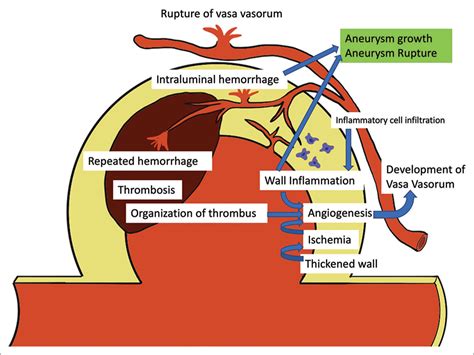 Surgical Neurology International