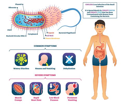 Vibrio Cholerae What Causes Cholera In Humans Ntwd