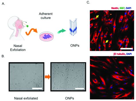 Non Invasive Isolation Of Olfactory Neuronal Precursors Onps A