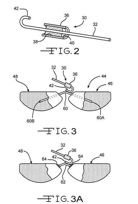 Capacitor Terminals Patented Technology Retrieval Search Results Eureka Patsnap