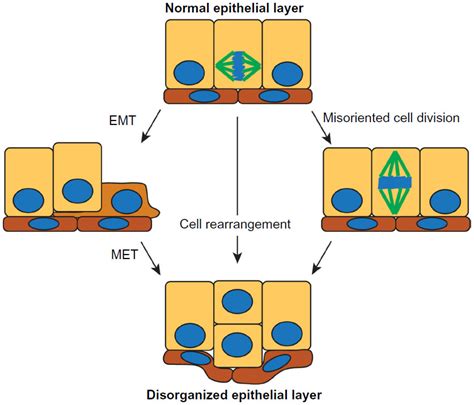 Emerging Role Of Cell Polarity Proteins In Breast Cancer Progression A