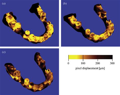 The Non Rigid Three Dimensional Registration Of The Mct Data From The