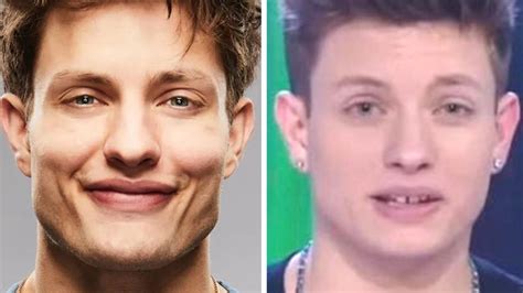 Matt Rife Before And After Before After