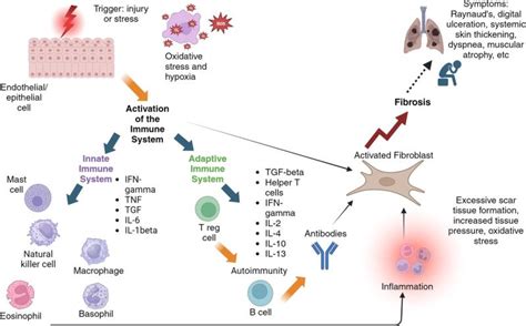 Antibody Pattern For Ild Patterns In Ssc Vikas Vats Phdmba