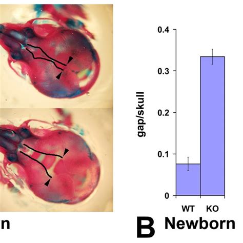 Wnt1 Ate1 Mice Have Defects In The Frontal Bones A Top View Of The Download Scientific