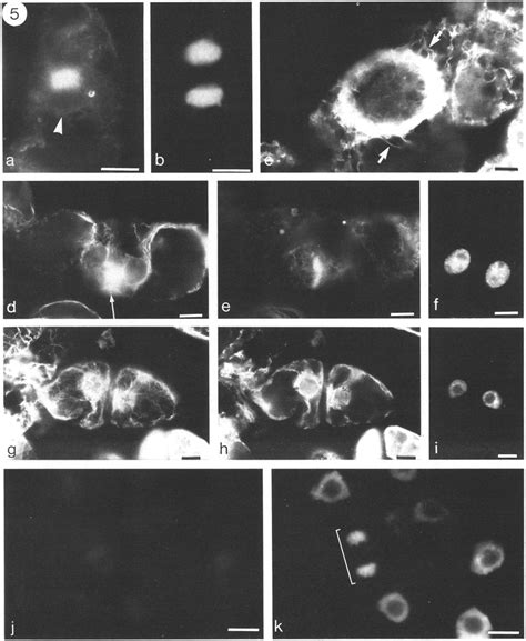 A Early Telophase Formation Of Phragmoplast Which Guides Cell Wall
